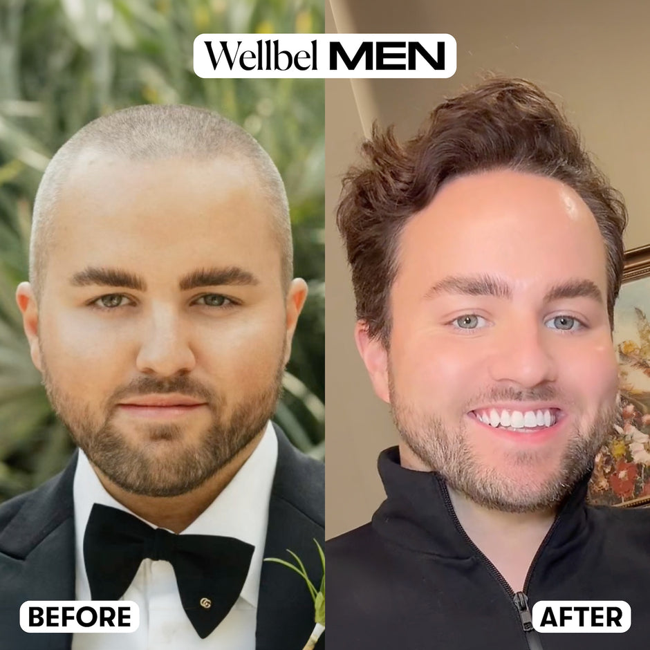 Quality Hair Supplements | Wellbel