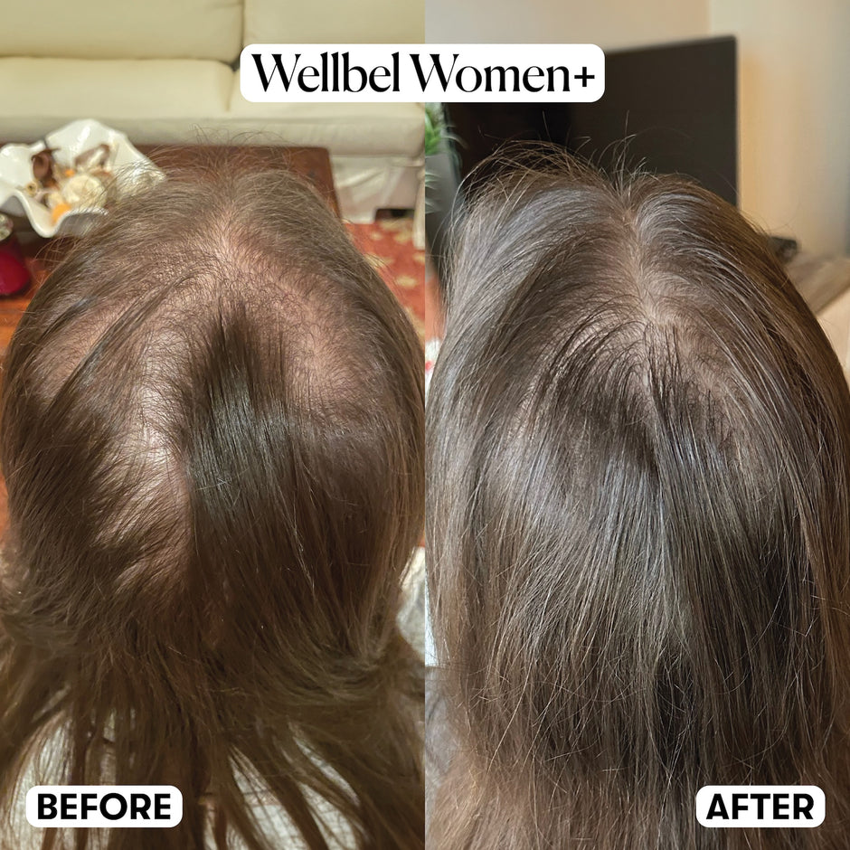 Wellbel Before And After