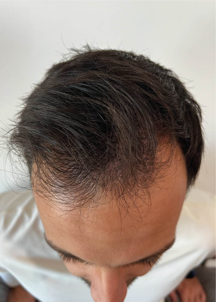Wellbel: Best Supplements For Hair, Skin, And Nails